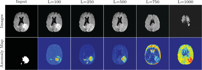 Understanding Diffusion Models: Types, Real-World Uses, and Limitations